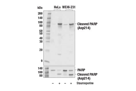 Cleaved Parp Asp214 Antibody Cell Signaling Technology