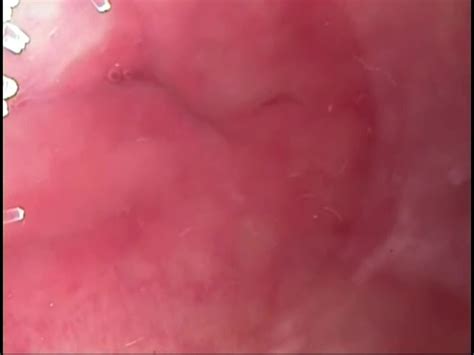 Tokyo Cum Shot Inside Pussy Scope 2 Streaming Video On Demand Adult