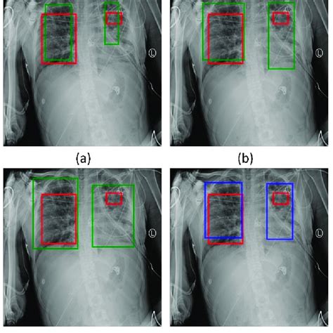 Pr Curves Of The Retinanet Models Initialized With Varying Weights For Download Scientific