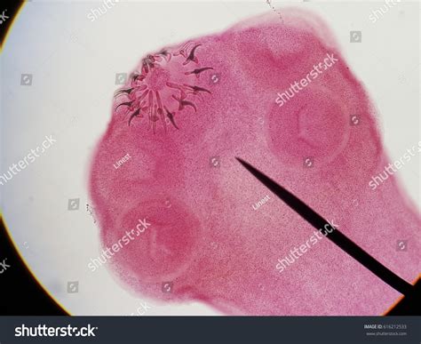 Taenia Scolex
