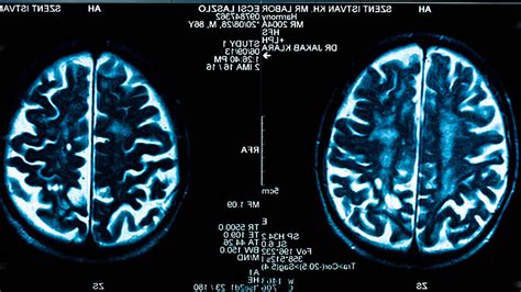 Computerized Axial Tomography Background Images Hd Pictures And Wallpaper For Free Download