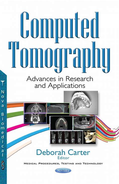 Computed Tomography Advances In Research And Applications Nova Science Publishers