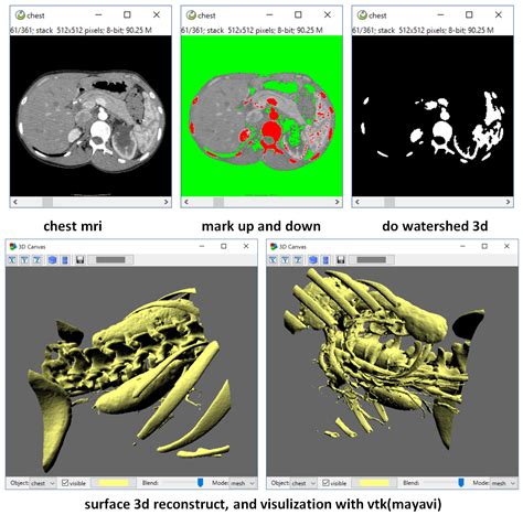 Github Image Pyitk Plgs Imagepy Plugins With Simpleitk