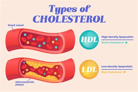 Cholesterol Chart
