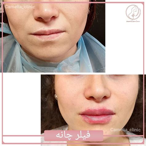 کلینیک زیبایی کاملیا