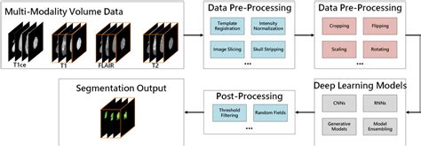 a conceptual illustration of a deep learning based brain tumor