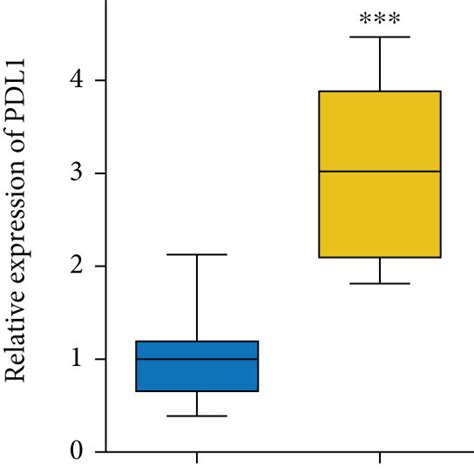Differential Expression Of Pdgfrβ In The Clinical Tissue Samples And