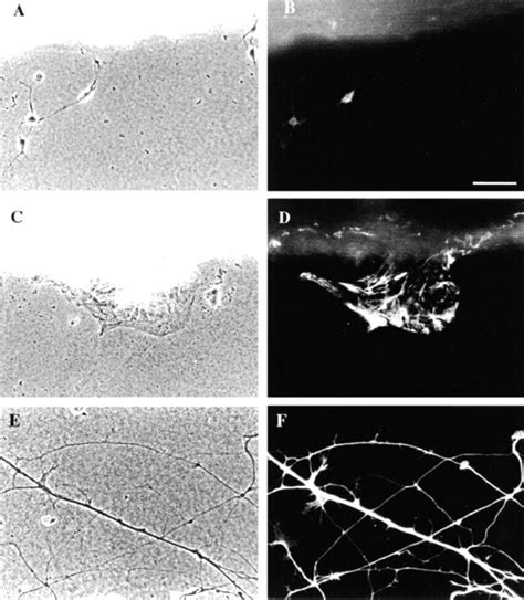Ptpμ Promotes Migration Of Several Cell Types From Chick Neural Retina Download Scientific