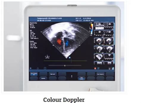 Ultrasound Test Centre Usg Centre In Mumbai अल्ट्रासाउंड सर्विस मुंबई