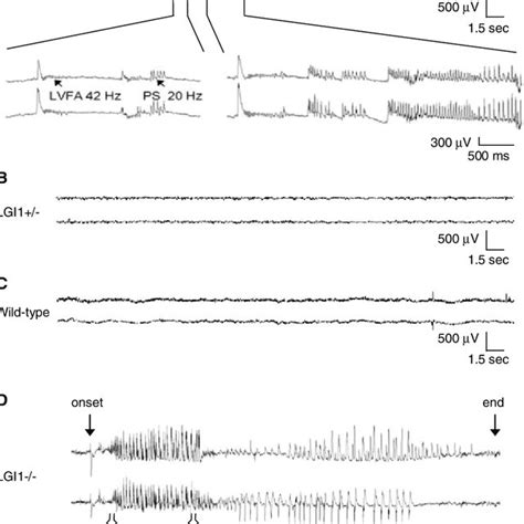 Video Eeg Recordings Of Lgi1 ÀÀ Lgi1 À And Wild Type Mice A