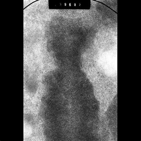 Cil41451 Cricetulus Griseus Epithelial Cell Cil Dataset