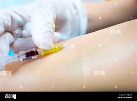 Closeup Of A Nurse Hand Administering A Medicine To A Patient Intravenously Intravenous Dropper