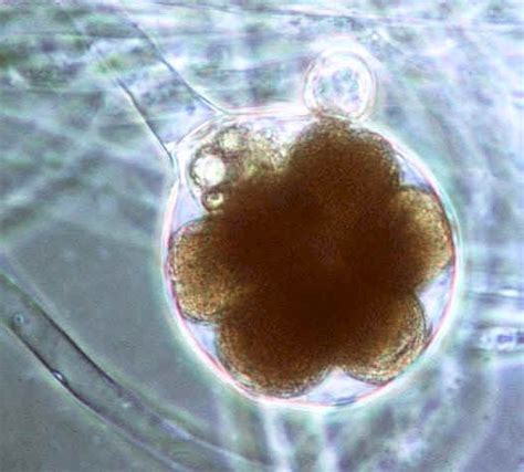 Protist Kingdom Science News