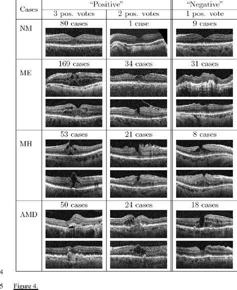 Figure 4 From Computerized Macular Pathology Diagnosis In Spectral