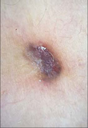 Whatisyourdiagnosis Our Dermatology Online