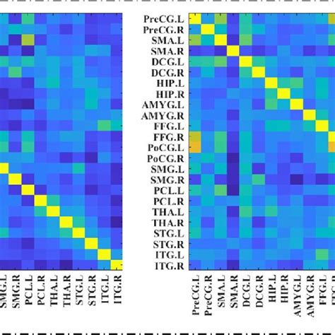 The Averaged Brain Networks Of The Asd And Td Groups A The Averaged Download Scientific