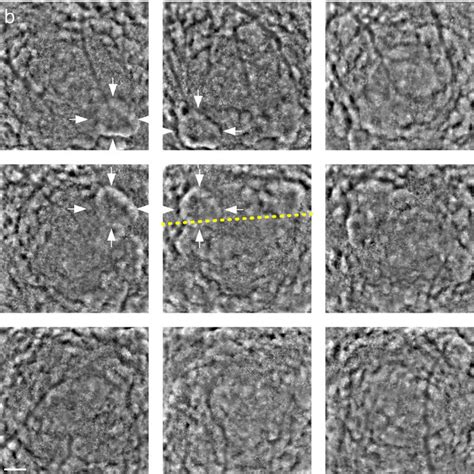 Source Images OCT B Scan A Through The Region Indicated With The Download Scientific Diagram