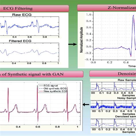 The Pre Processing Steps Of Ecg Signals Download Scientific Diagram