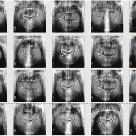 Conditional Generative Adversarial Network The Objective Function Of A Download Scientific