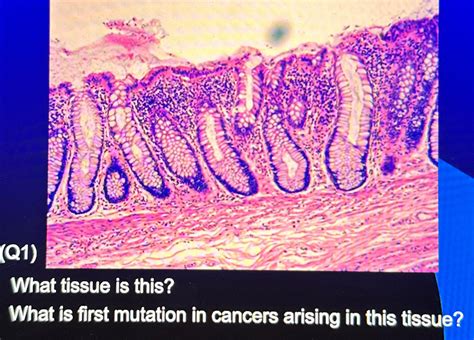 Solved Q1 What Tissue Is Thiswhat Is First Mutation In