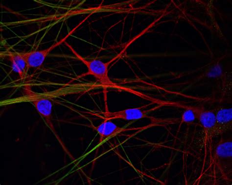 Stemtech Custom Stem Cell Reprogramming