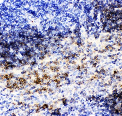 Anti Cd79b Cd79 Beta Antibody Rabbit Anti Human Polyclonal Lsbio