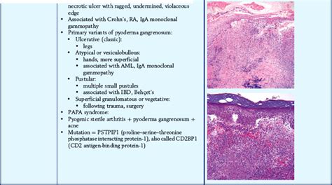 Vasculopathic Reaction Pattern Clinical Gate