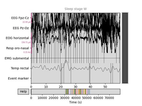 sleep stage classification from polysomnography psg data — mne 0 22 1