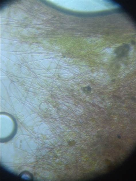 Trying To Id Algea With Microscope Reef2reef Saltwater And Reef