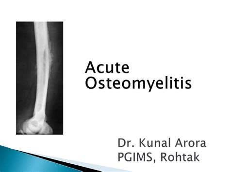 Acute Osteomyelitis Pptx