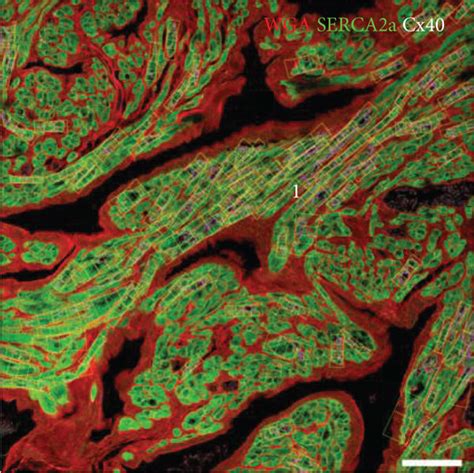 Automatic Quantification Of Cx40 And Cx43 Lateralization Cardiomyocyte Download Scientific