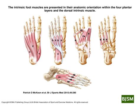 The Intrinsic Foot Muscles Are Presented In Their Anatomic Orientation