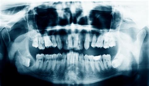 Premium Photo Scan Teeth