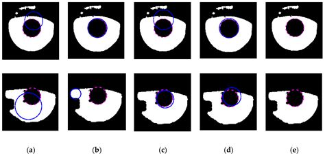 Robust Iris Segmentation Algorithm In Non Cooperative Environments