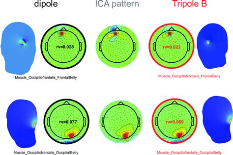 two exemplary source models and their solution in source localization
