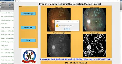 Types Of Diabetic Retinopathy Detection Using Image Processing Matlab Project With Source Code