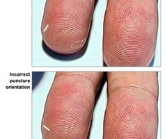 Advanced Phlebotomy Medtraining Flashcards Quizlet