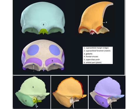 Frontal And Right Temporal Bone Quiz