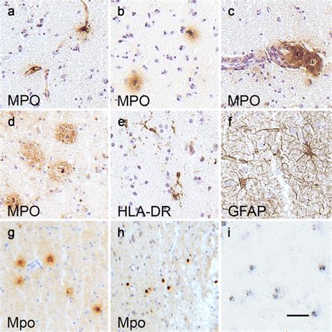 Typical Cellular Localization Of Myeloperoxidase Mpo Expression In