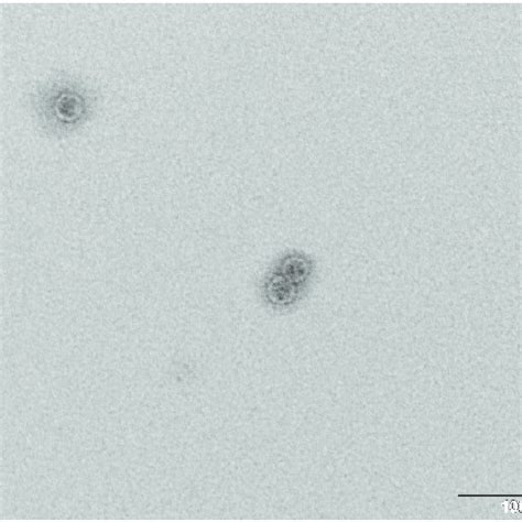 Transmission Electron Microscopy Tem Photograph Of The Intact Ms2