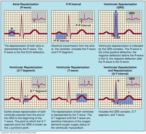 Best ECG Images On Pinterest Med Babe Being A Nurse And Cardiology