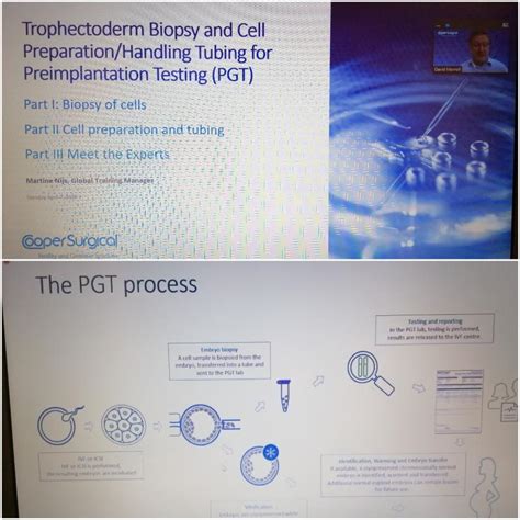 Marta Cherubini On Linkedin Two Days Of Webinars On Trophectoderm