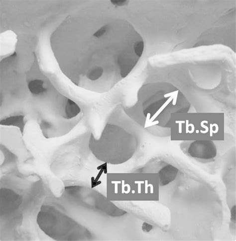 Trabecular Microstructural Parameters Were Measured Using Download Scientific Diagram