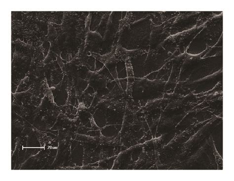 Cell Morphology In Scanning Electron Microscopy Sem Of 3t3 Fibroblast