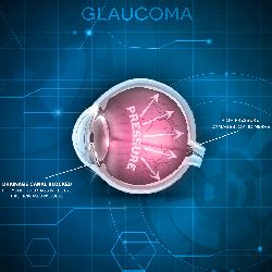 Glaucoma Archives Pendleton Eye Center