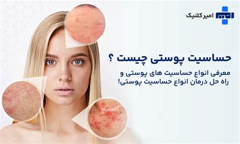 سکس یا رابطه جنسی، اصول و انواع روش های آن کلینیک تخصصی امیر