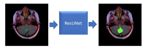 GitHub Sathishvp Brain Tumour Detection This Would Drastically Reduce The Cost Of Cancer