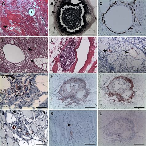 Histopathological Investigations Of Formalin Fixed Paraffin Embedded Download Scientific