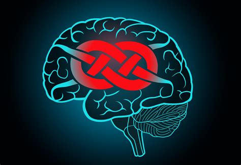 Specialties Intractable Epilepsy