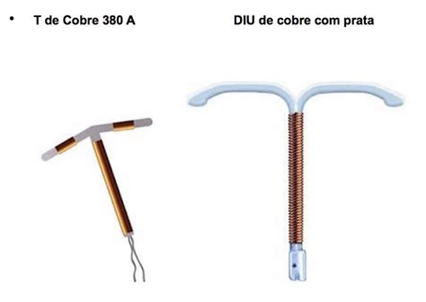 Diu Método Contraceptivo é Feito Com Produtos Da Mineração Portal Da